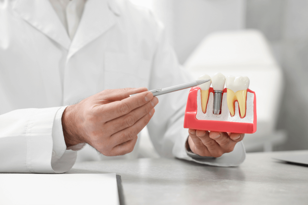 Endodontics Costa Rica - Smile For Everyone